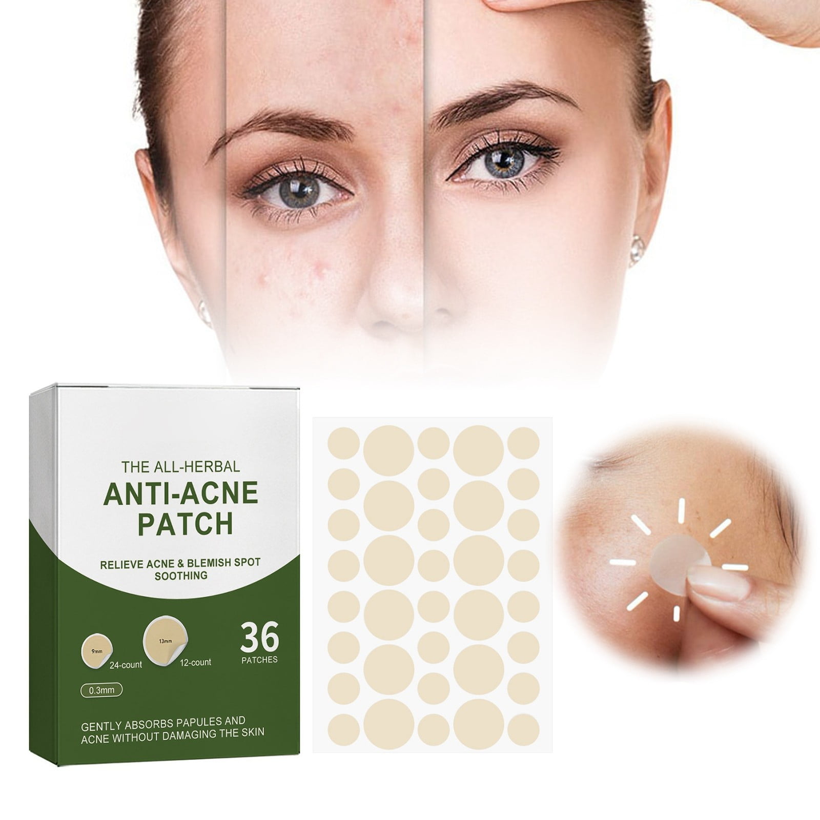 Patch Is Gentle And Clean Helping To Facial Defects Concealer Appearance Breathable Face Care ...