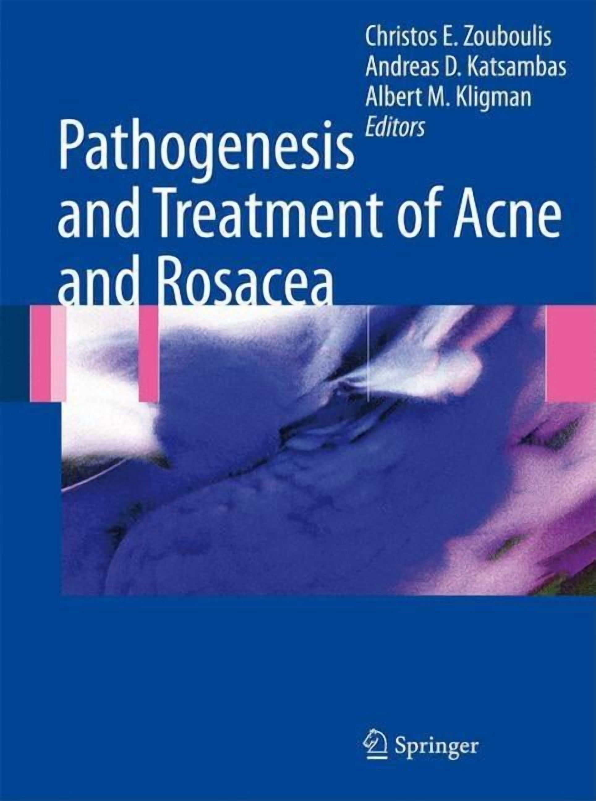 Pathogenesis and Treatment of Acne and Rosacea, (Hardcover) - Walmart.com
