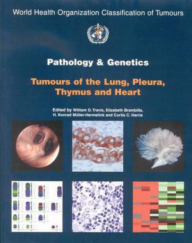 Pre-Owned Pathology and Genetics of Tumours of the Lung, Pleura, Thymus ...