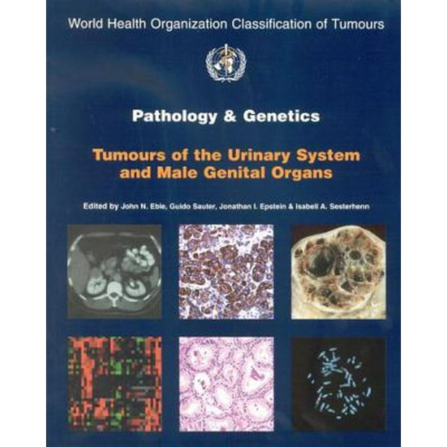 Pre-Owned Pathology and Genetics of Tumours of the Urinary System and ...