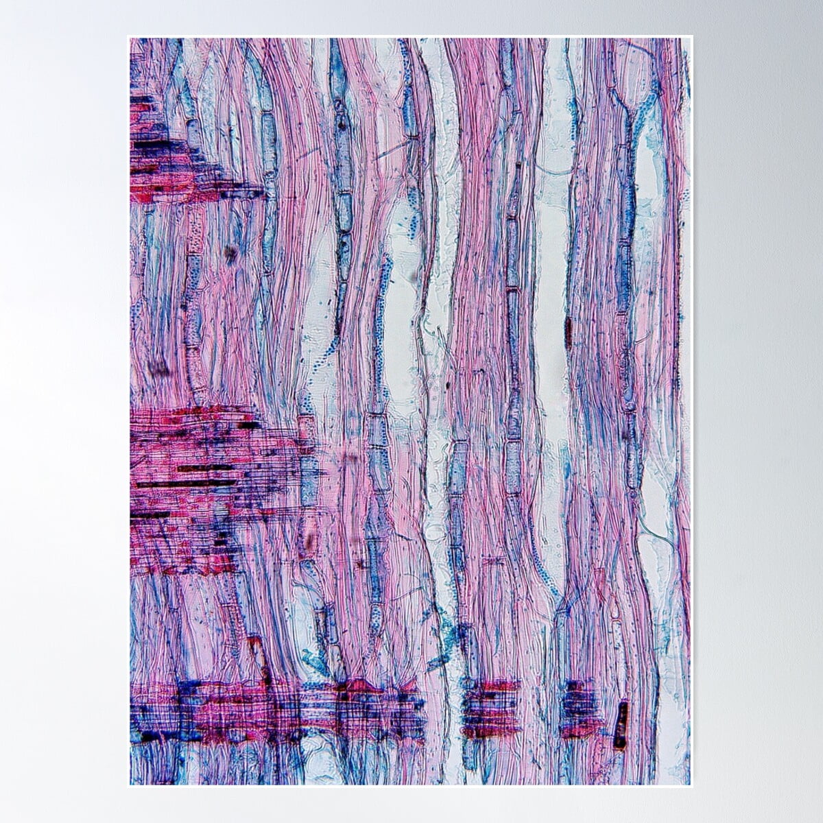 Pear Tree, Wood Cells, Radial Section; Plant Anatomy, Microscopy Poster ...