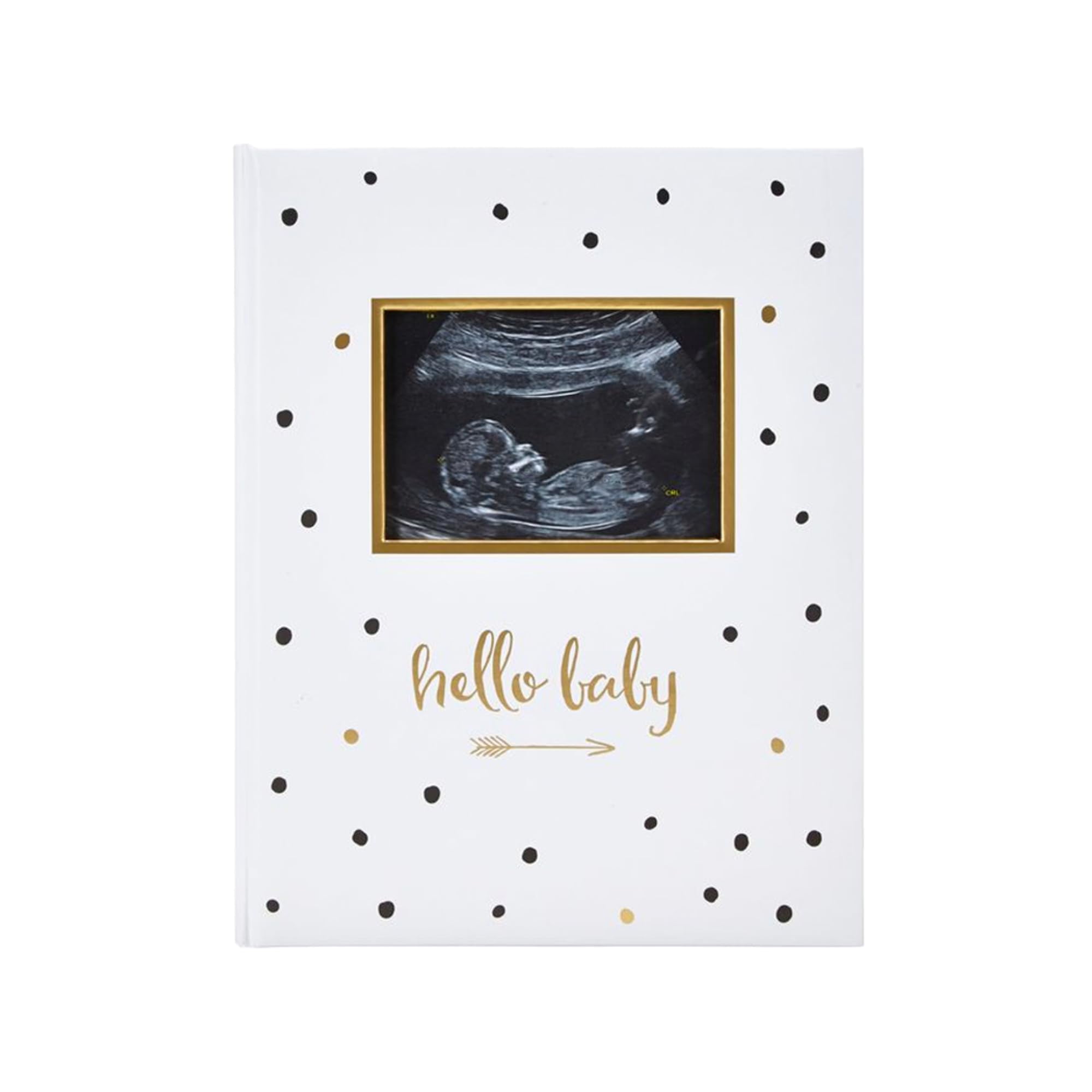 Pearhead Hello Baby First 5 Years Memory Book, Gender-Neutral Baby ...