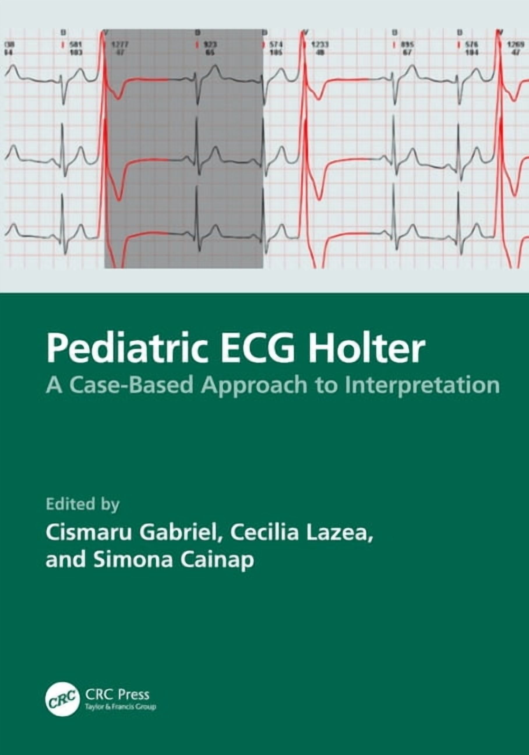 Pediatric Ecg
