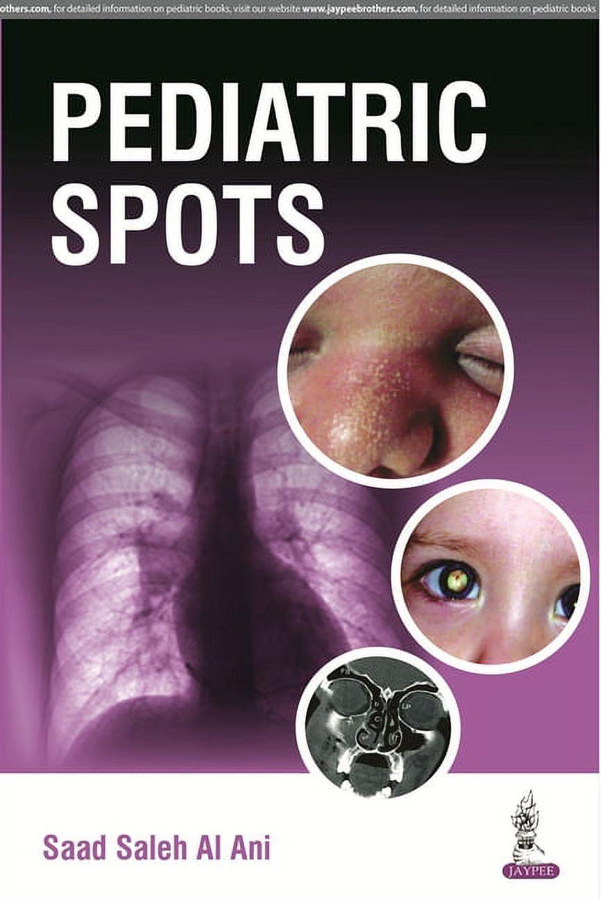 Pediatric Spots - Al Ani, Saleh Saad - Walmart.com