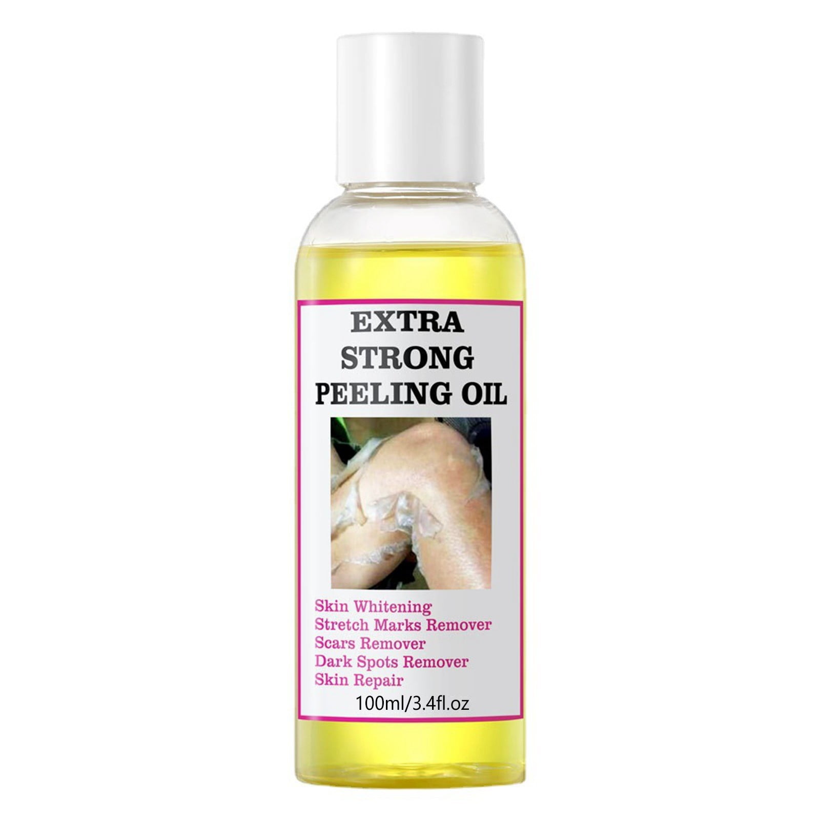 Peeling Oil Exfoliating Oil Elbows Knees Fingers Black Yellow Oil 110ml ...