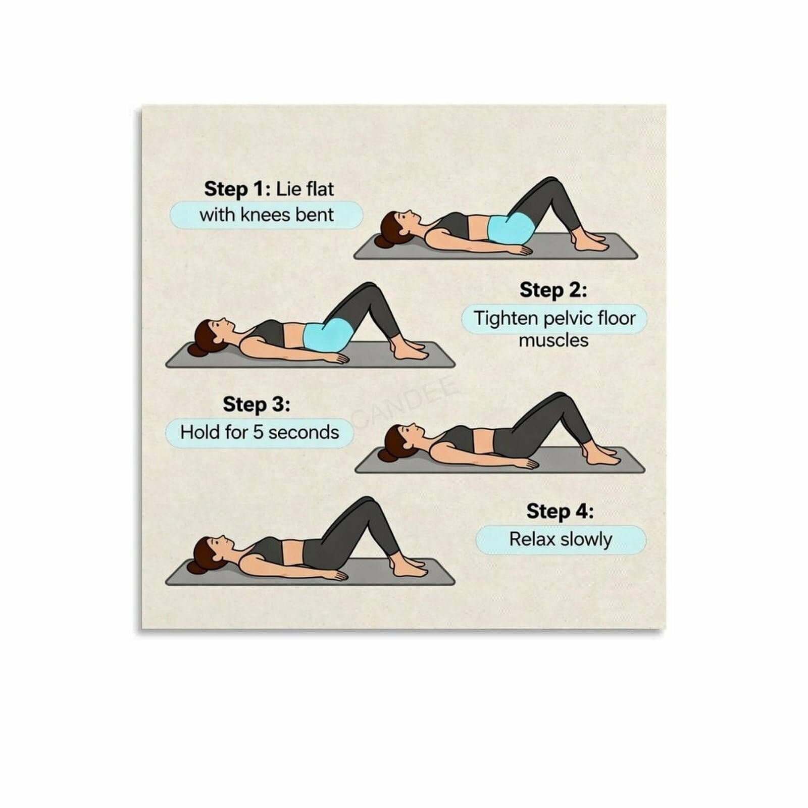 Pelvic Floor Health Guide Poster Recovery Tips for Bladder Control Home ...