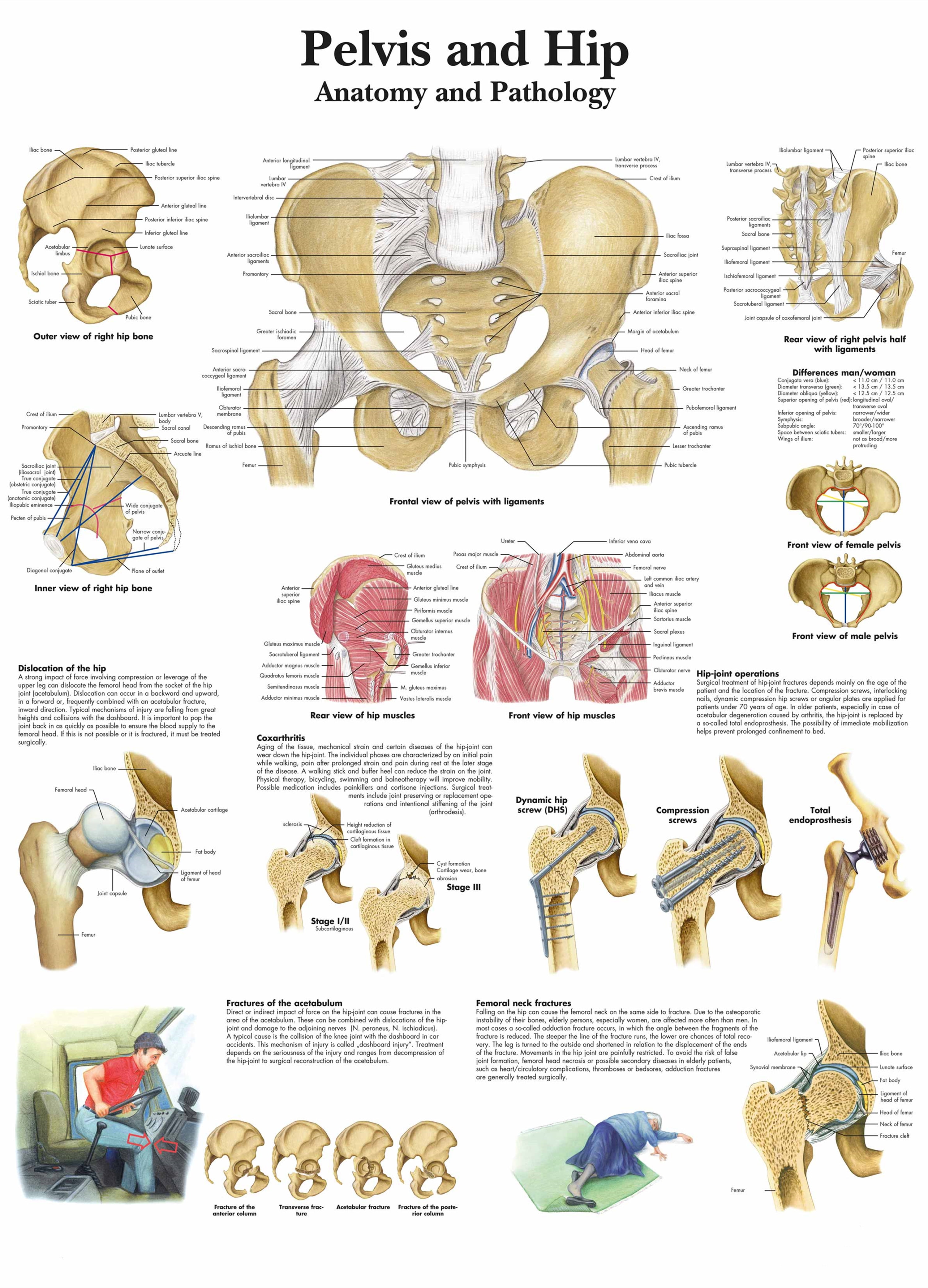 Pelvis and Hip Anatomy and Pathology Wall Art Posters Canvas Print ...
