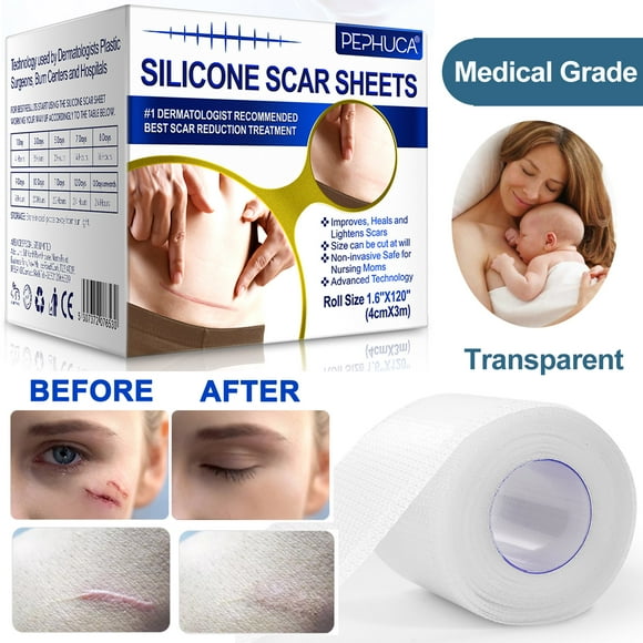 Silicone Scar Pads