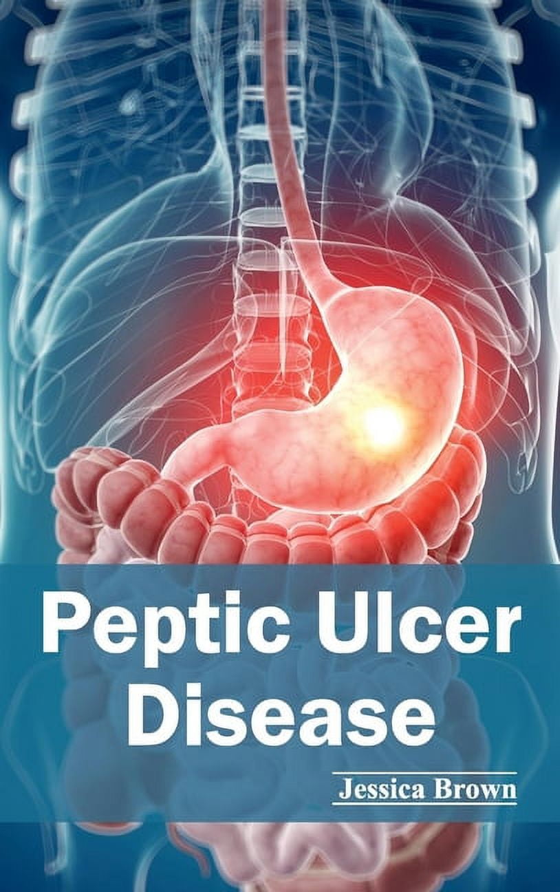 Peptic Ulcer Disease, (Hardcover) - Walmart.com