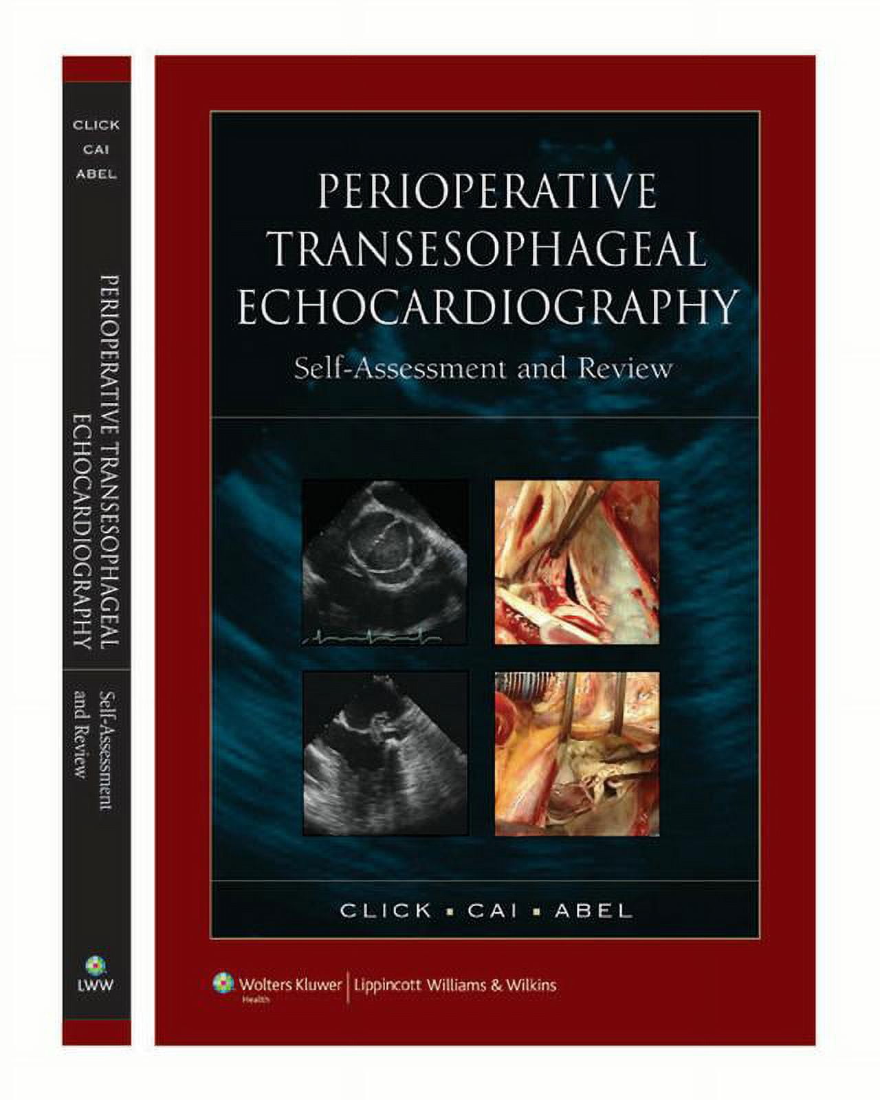 Perioperative Transesophageal Echocardiography Self-Assessment and ...