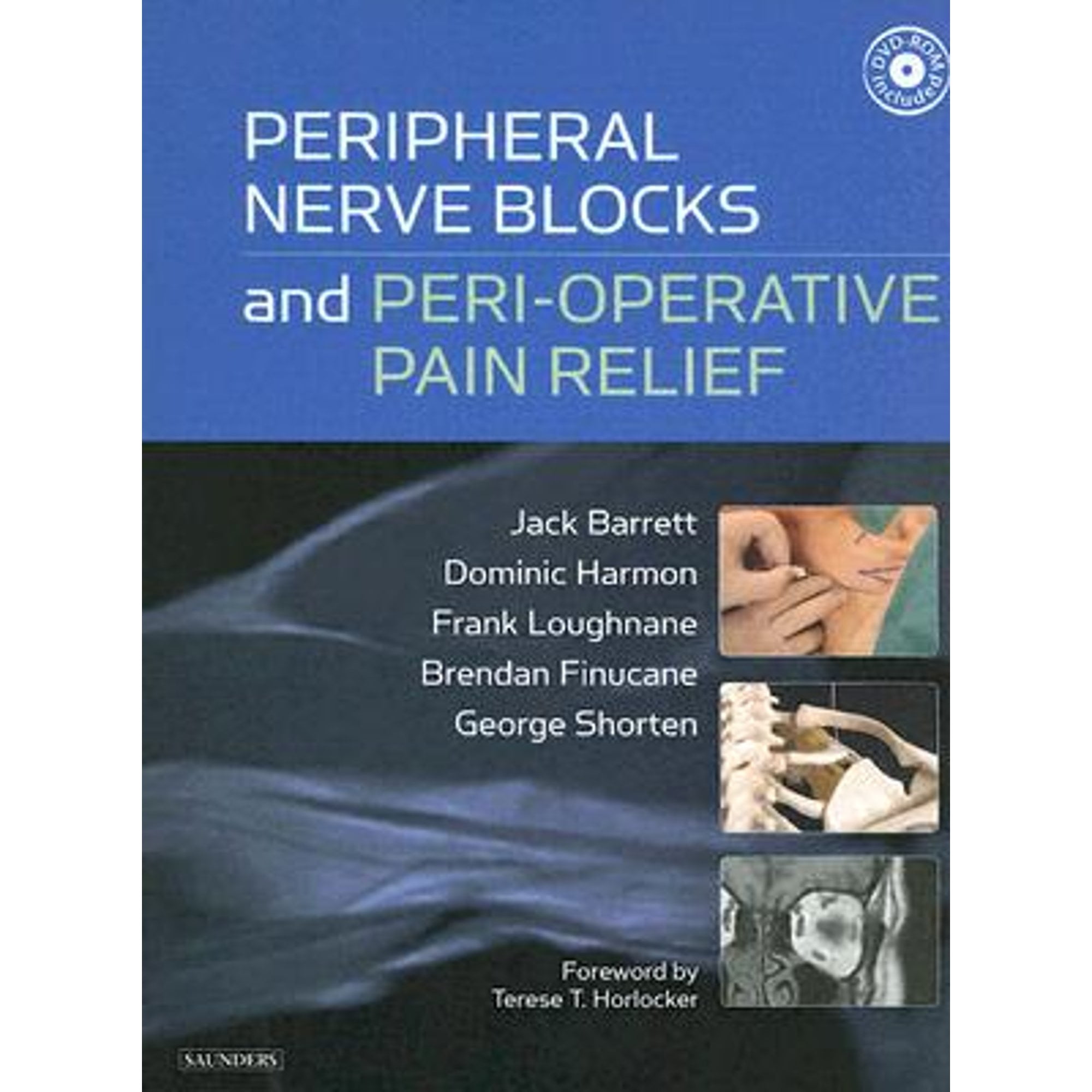 Pre-Owned Peripheral Nerve Blocks and Peri-Operative Pain Relief [With ...