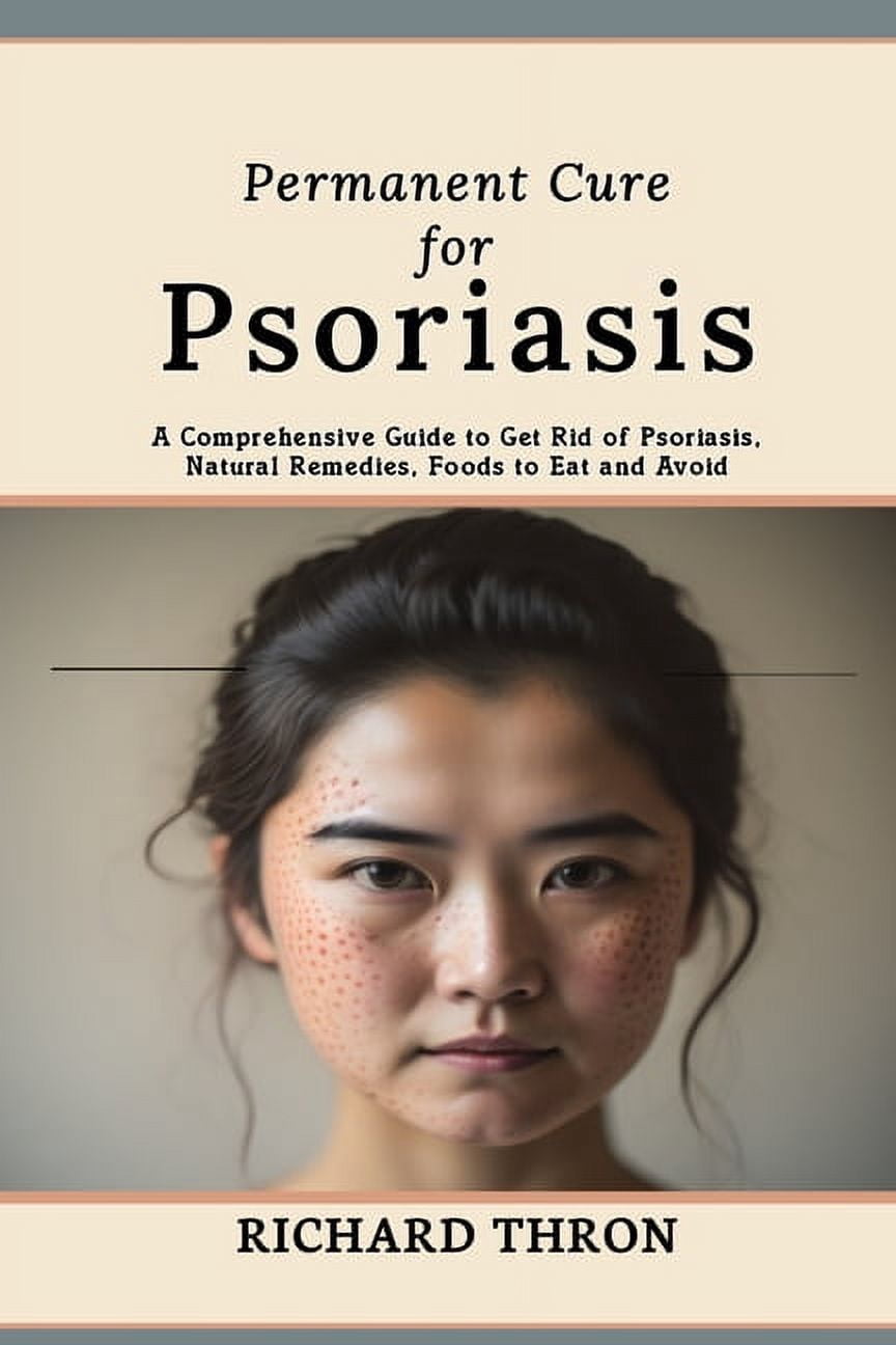 Permanent Cure for Psoriasis: A Comprehensive Guide to Get Rid of ...