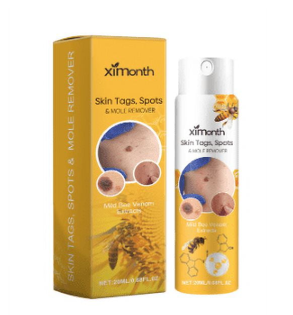 Personal Skin Care,Wart Ointment Smooth Skin Fade Mole Spotting Wart ...