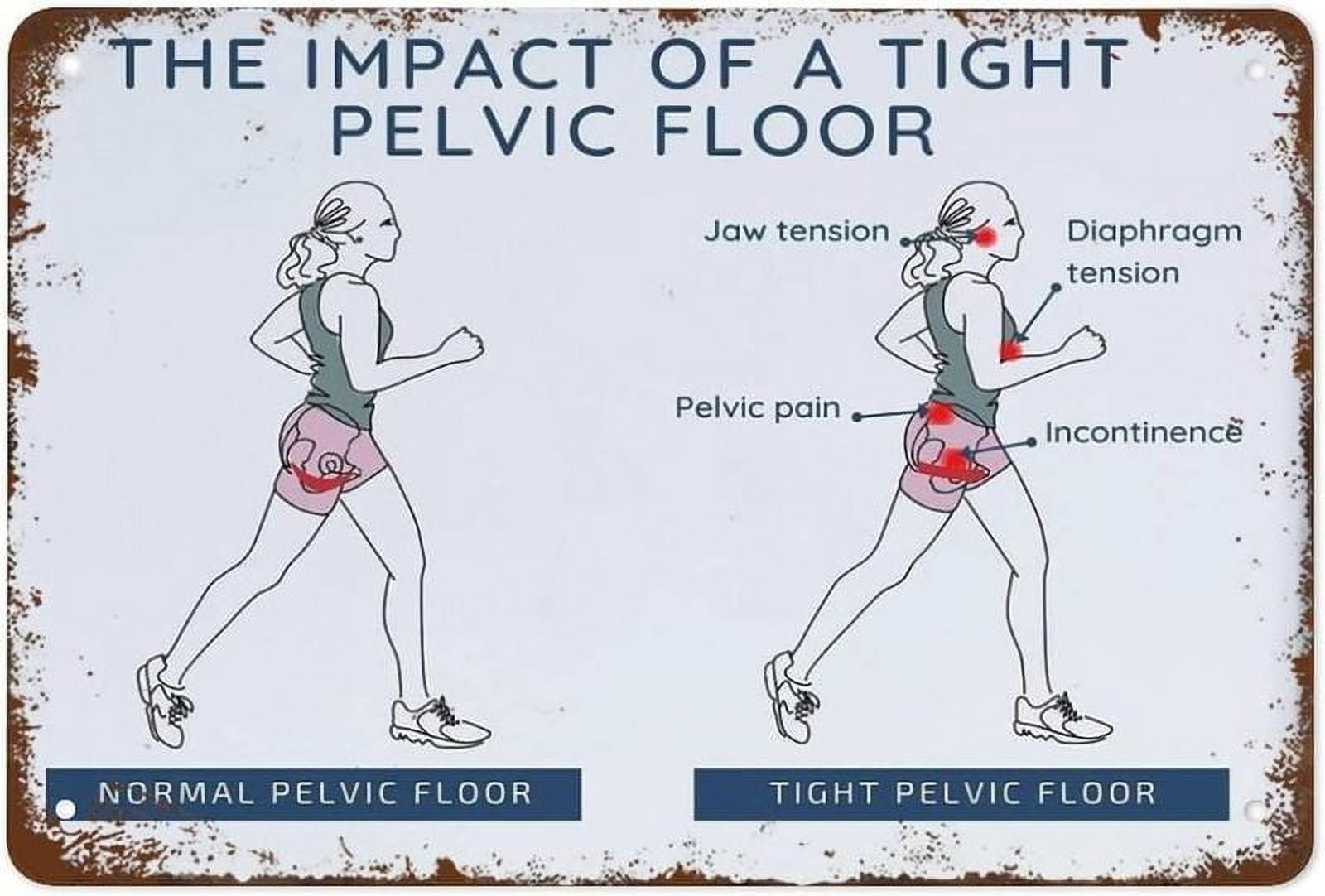 Physical Therapy Pelvic Floor Hypertonic Pelvic Floor Pelvic Art Pelvic ...