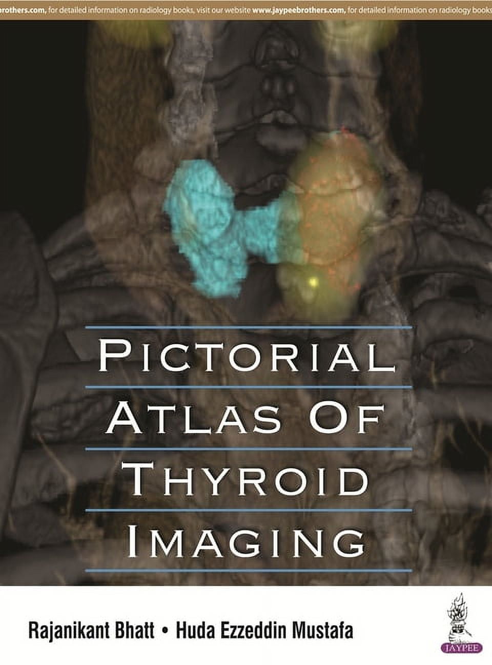 Pictorial Atlas Of Thyroid Imaging: 2016 - Walmart.com