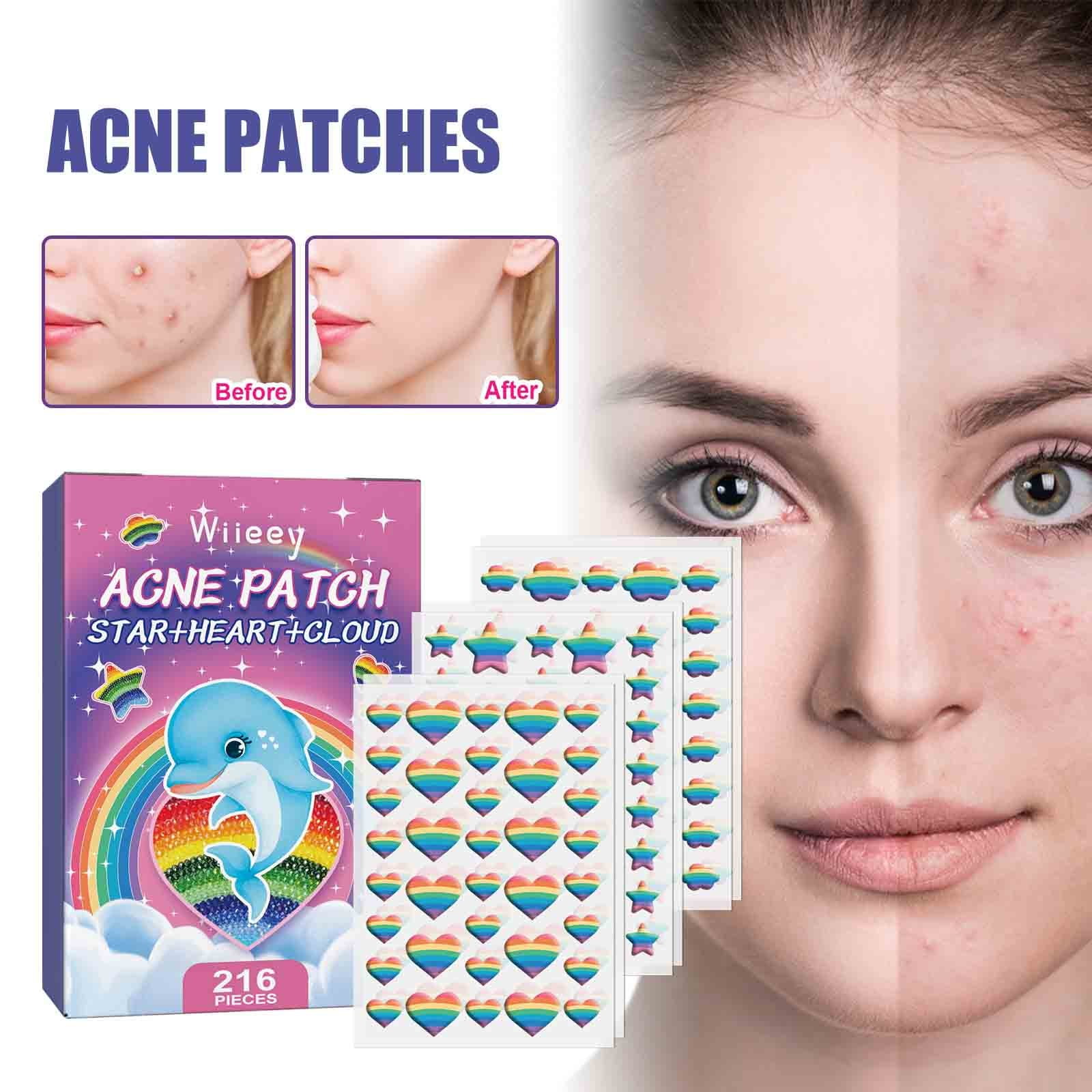 Pimple Patches,Clearance,Pimple Patch 216 Counts Patch With Star-Shaped ...