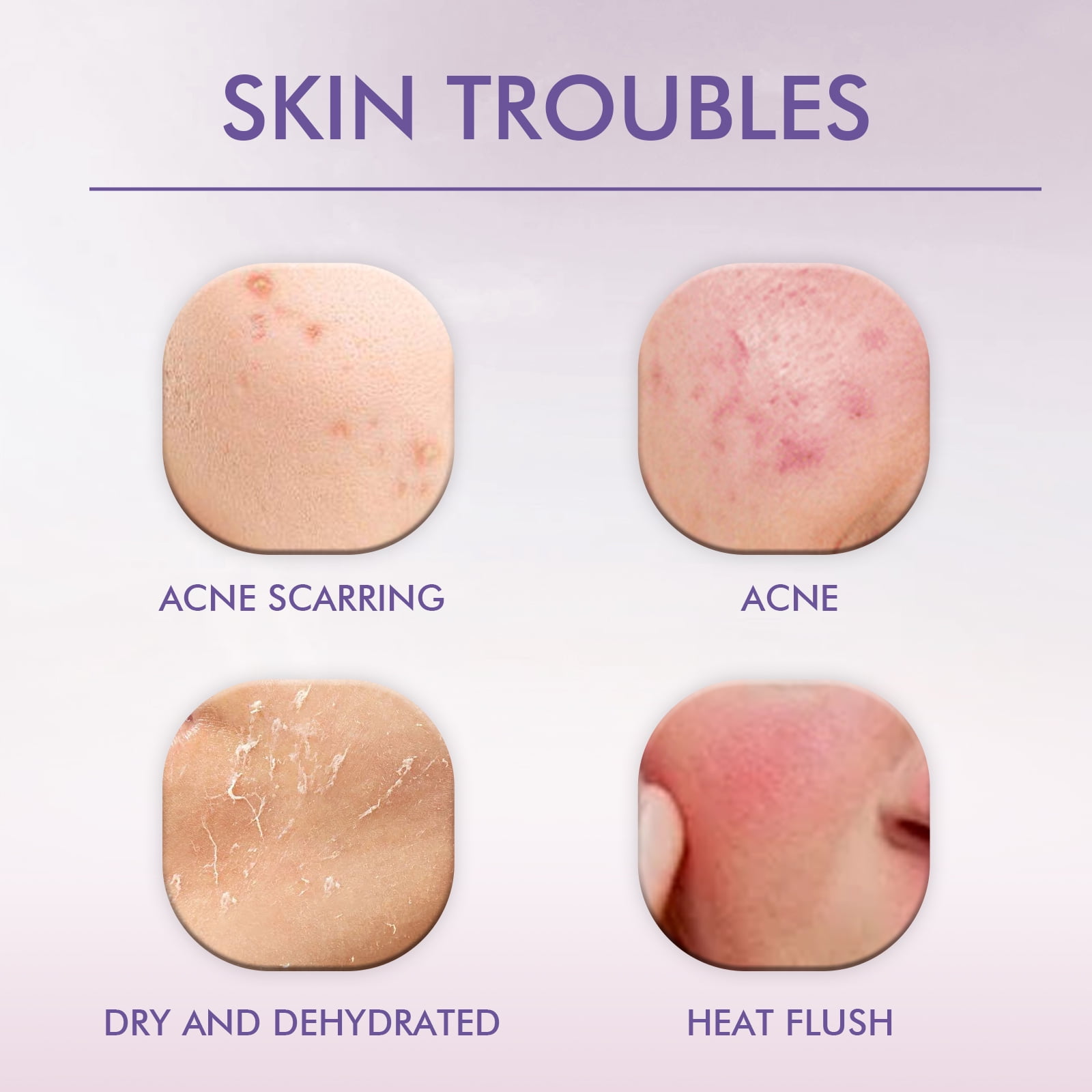 Pimple Patches,Stickers Reduce Patches Nose Reduce Pores Chin Cheeks ...