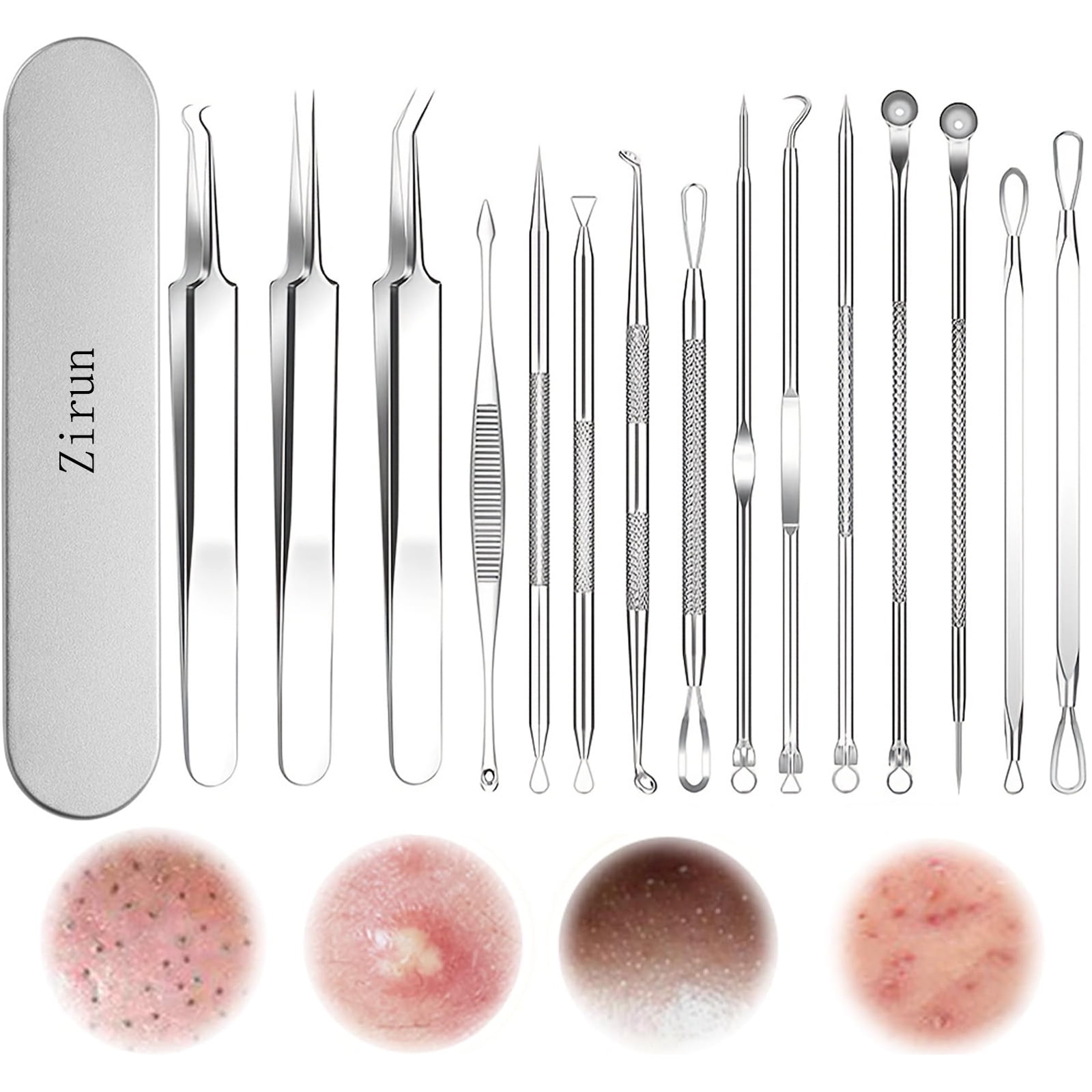 Zirun Blackhead Remover Tool Kit, 15 Pcs Stainless Steel Pimple ...