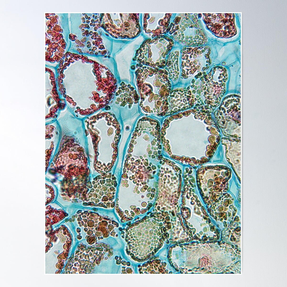 Pine Cone, Fat Cells; Plant Anatomy, Microscopy Poster Wall Art, Modern ...