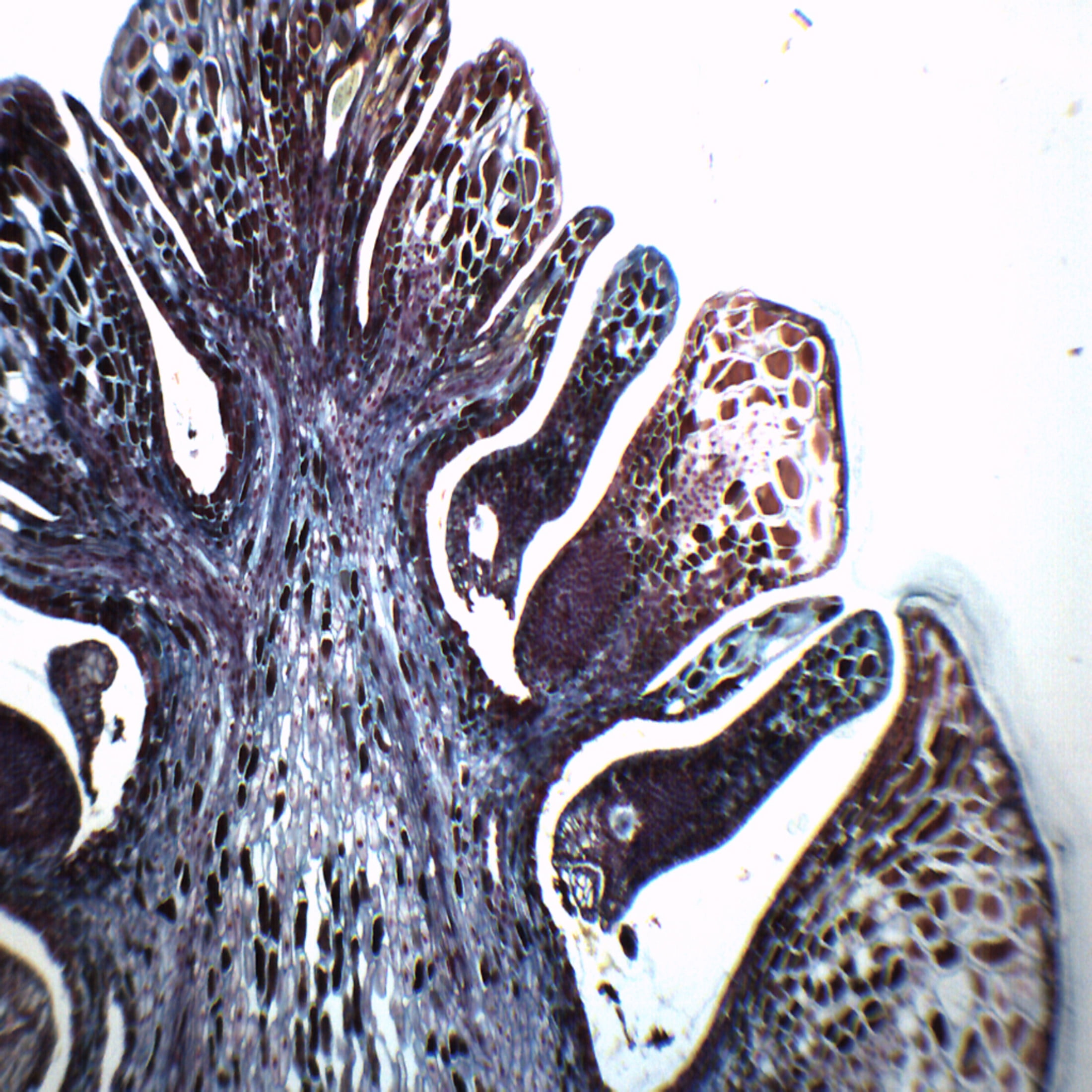 Pine Ovulate Cone, Longitudinal Section - Prepared Microscope Slide ...