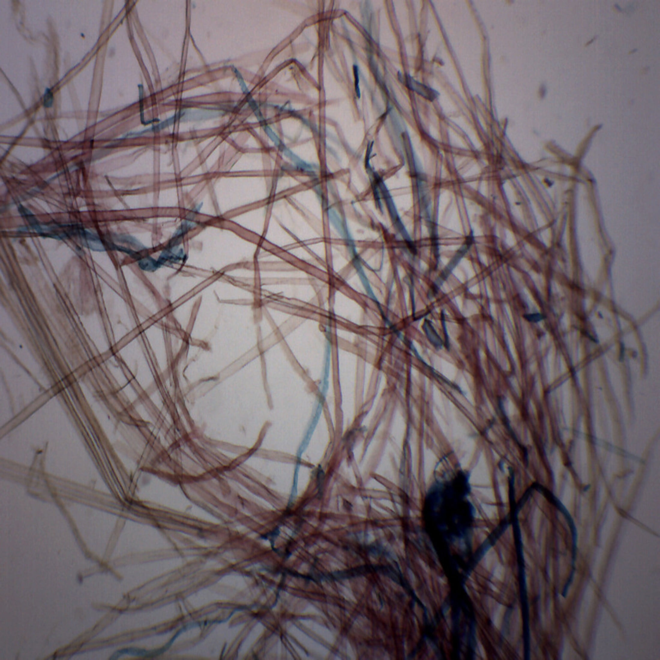 Pine Wood Maceration - Wholemount - Prepared Microscope Slide - 75 x ...