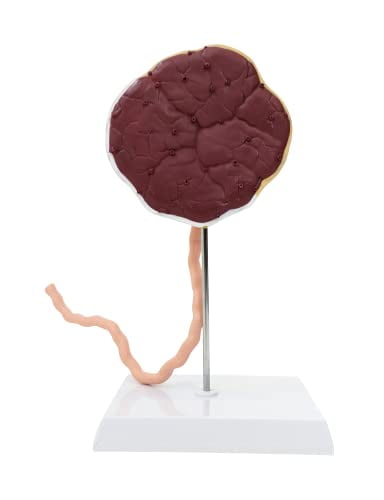 Placenta Model with Removable Umbilical Cord Anatomical Model - Walmart.com