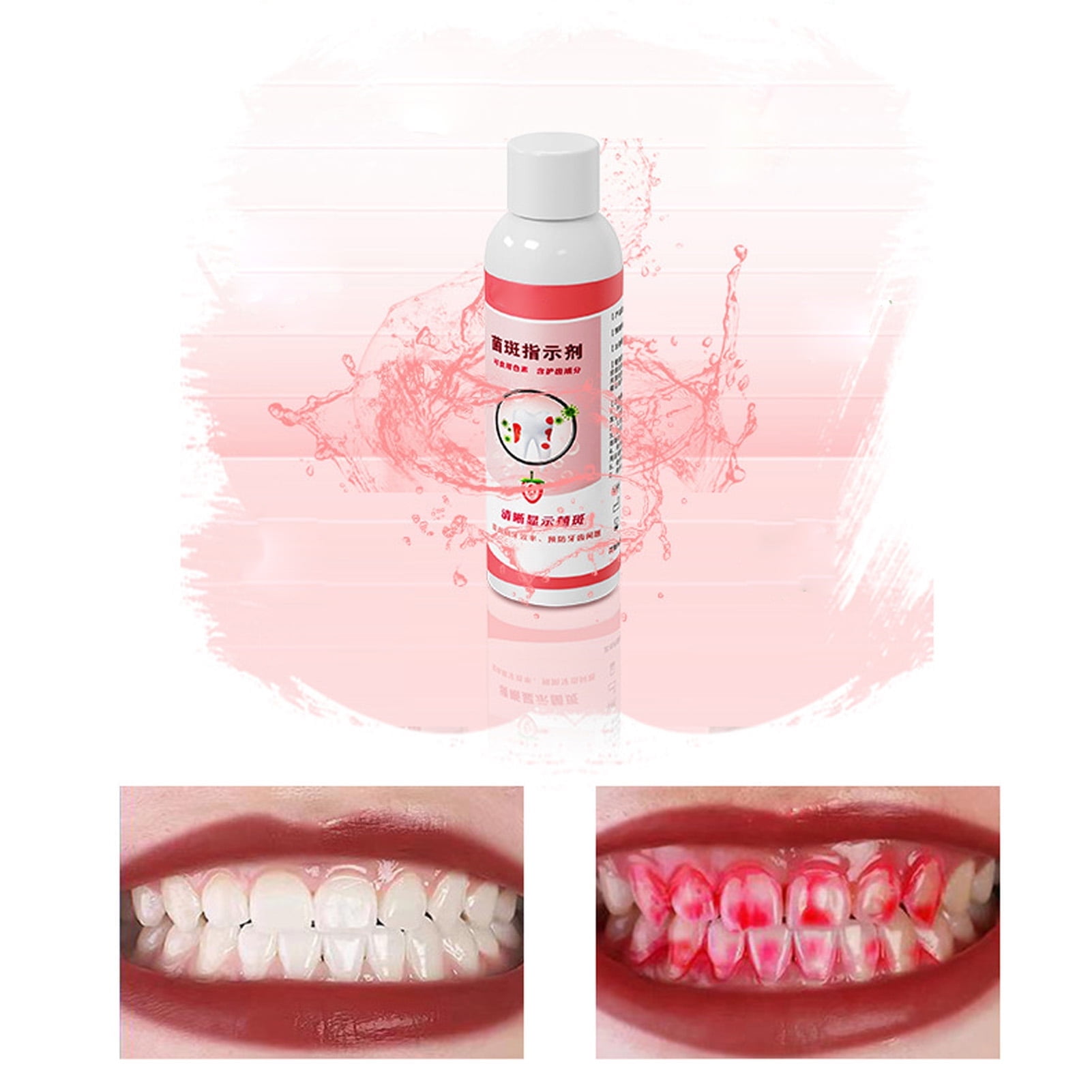 Plaque Disclosing Agent, 60ml Dental Plaque Indicator with Scale Cup ...