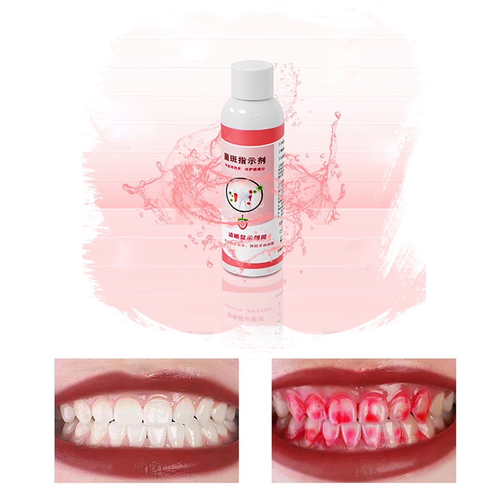 Plaque Disclosing Agent, 60ml Dental Plaque Indicator with Scale Cup ...