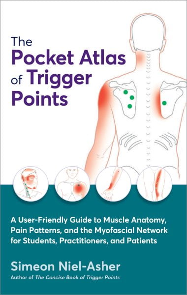 Trigger Points Map