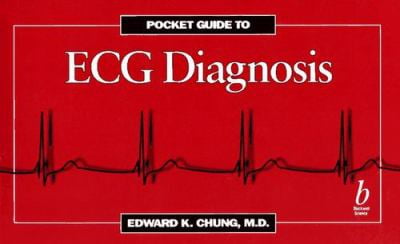 Pre-Owned Pocketguide to ECG Diagnosis 0865424993 (Hardcover - Used ...