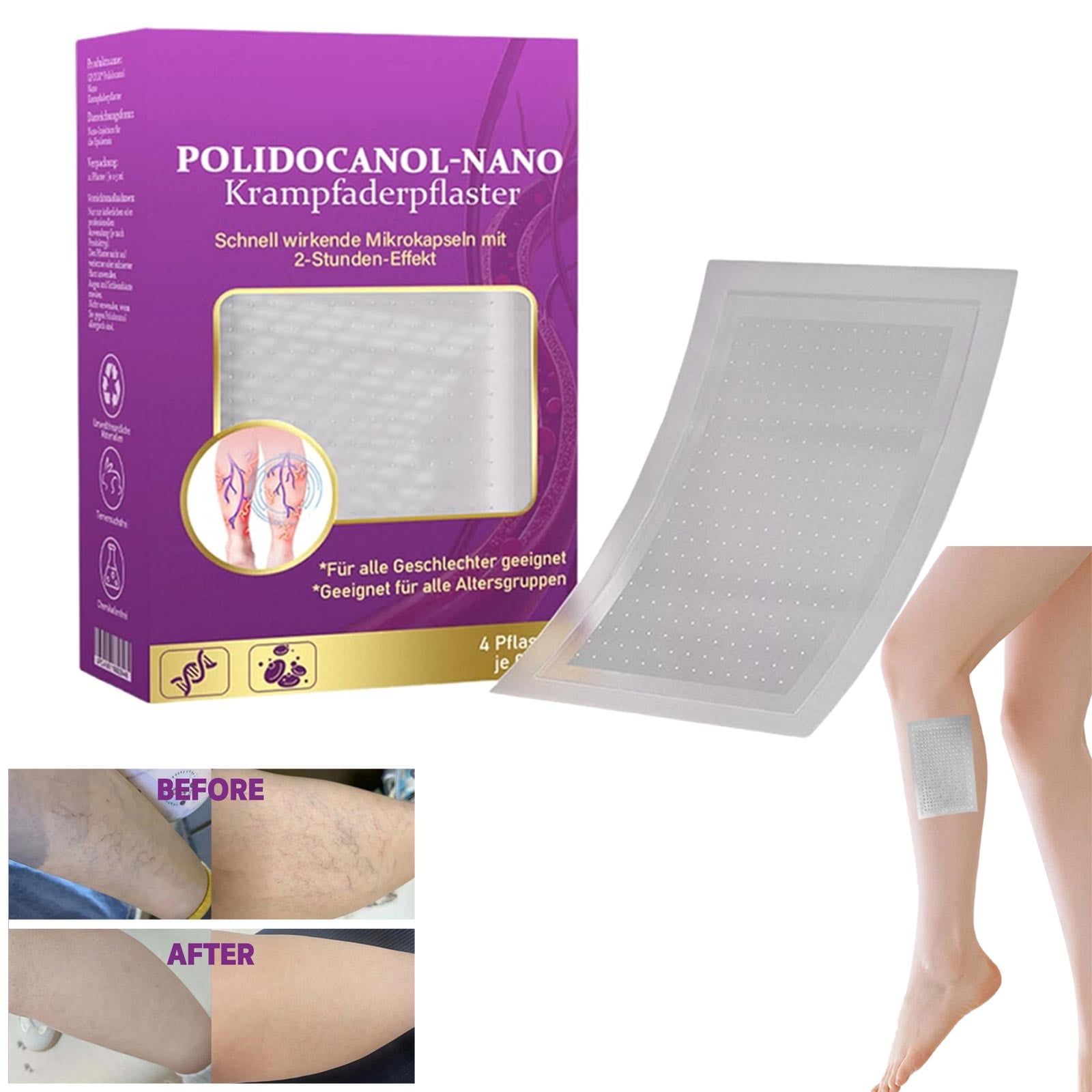 Polidocanol Nano Patch Against Varicose Veins, Professional Nano ...