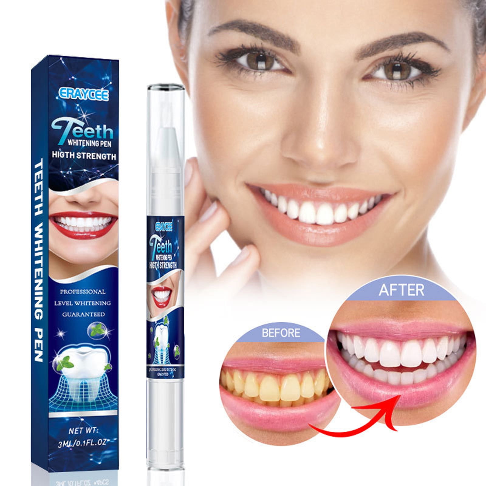 Popular Picks, Whitening Pen for Teeth, 3.0ML Rotary Tooth Whitener ...