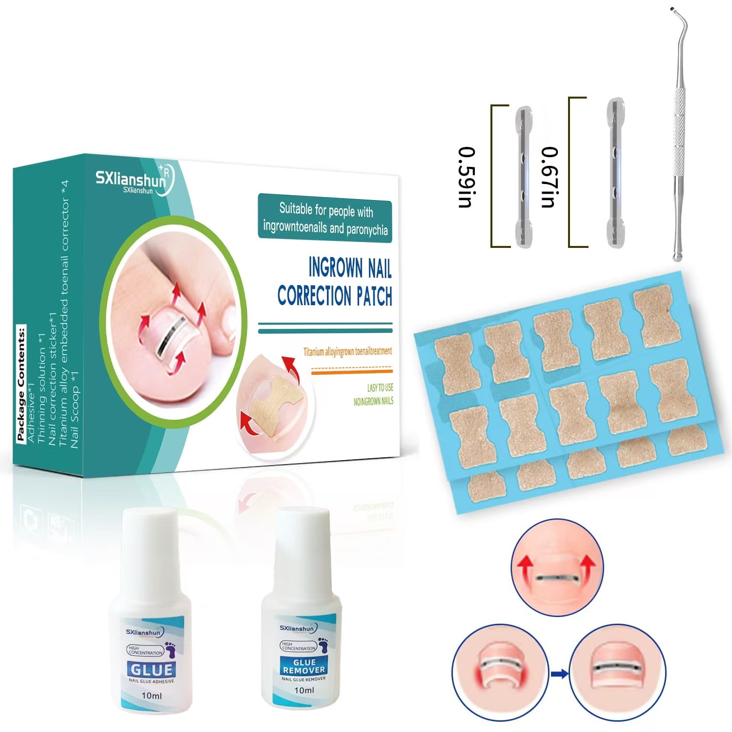 Portable Ingrown Toenail Corrector Titanium Nail Repair Tool for Home ...