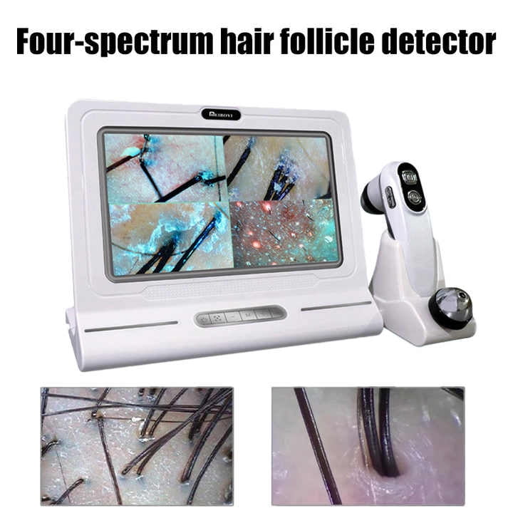 Portable Scalp Hair Follicle Scanner Detector Skin & Scalp Hair ...