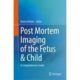 Post Mortem Imaging of the Fetus & Child: A Comprehensive Guide, (Hardcover) - Walmart.com