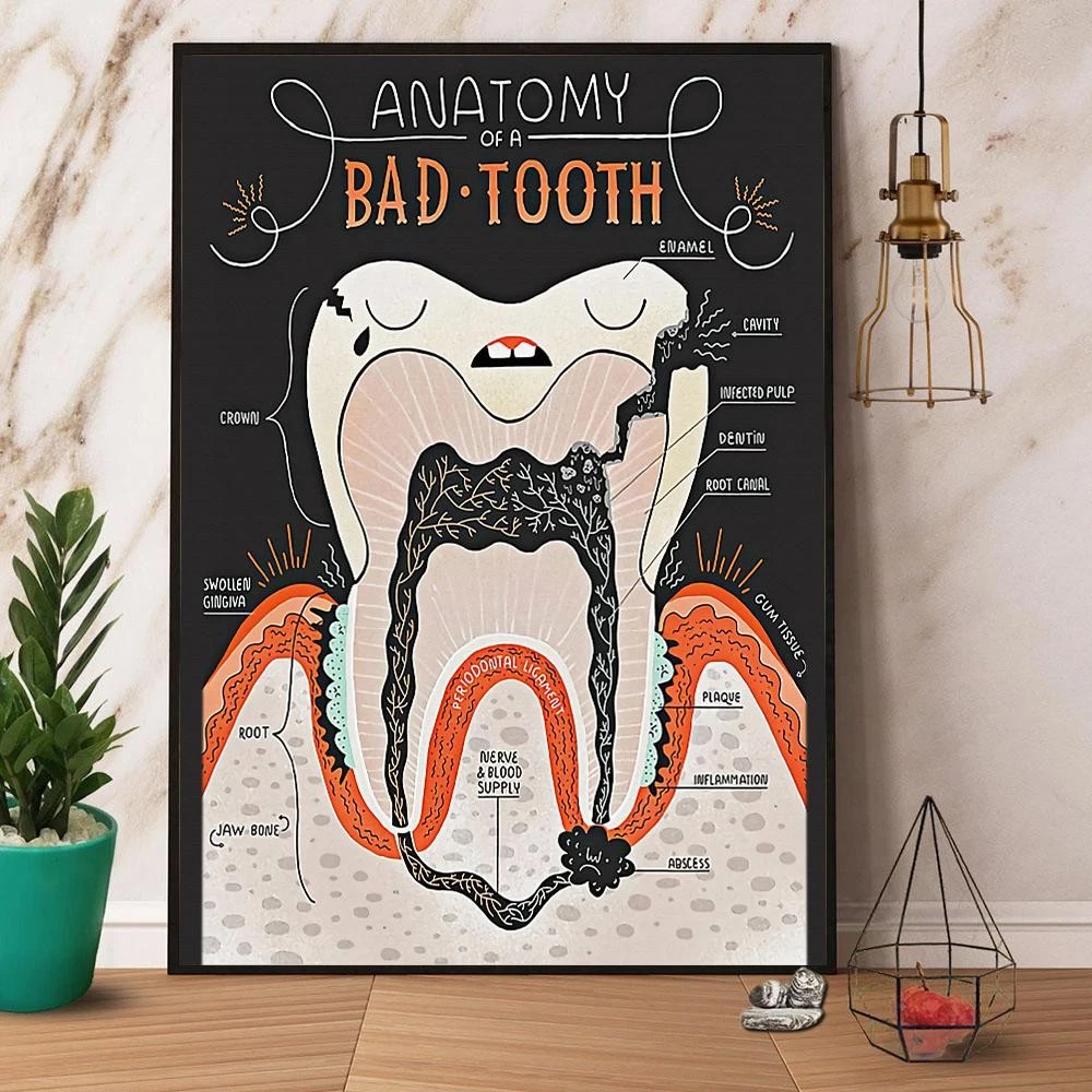Poster Dentist Anatomy Of A Bad Tooth Paper Matte Wall Art Decor Wall ...