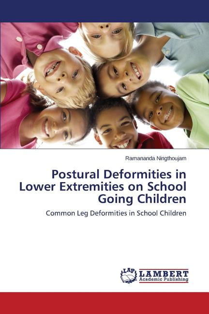 Postural Deformities in Lower Extremities on School Going Children ...