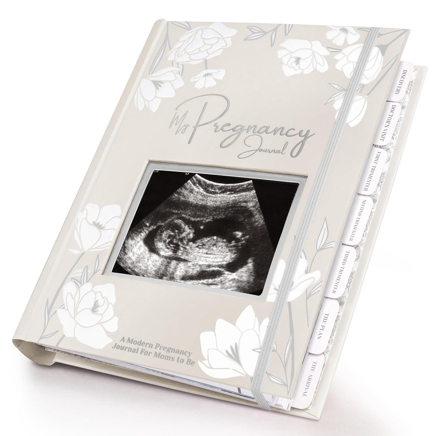 Pregnancy Journal, Pregnancy Announcements - 80 Pages Hard Cover Baby ...