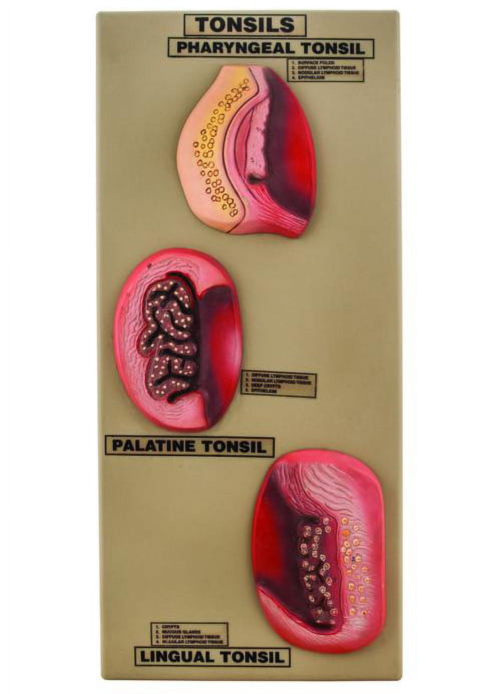 Lingual Tonsil Model