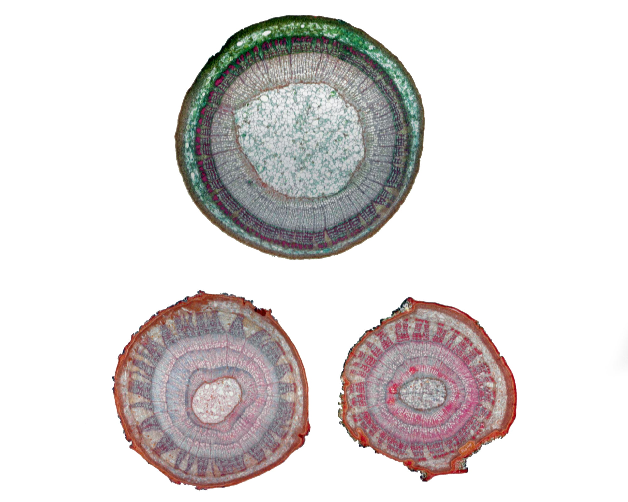 Prepared Microscope Slide, Basswood (Tilia) One, Two, and Three Years ...