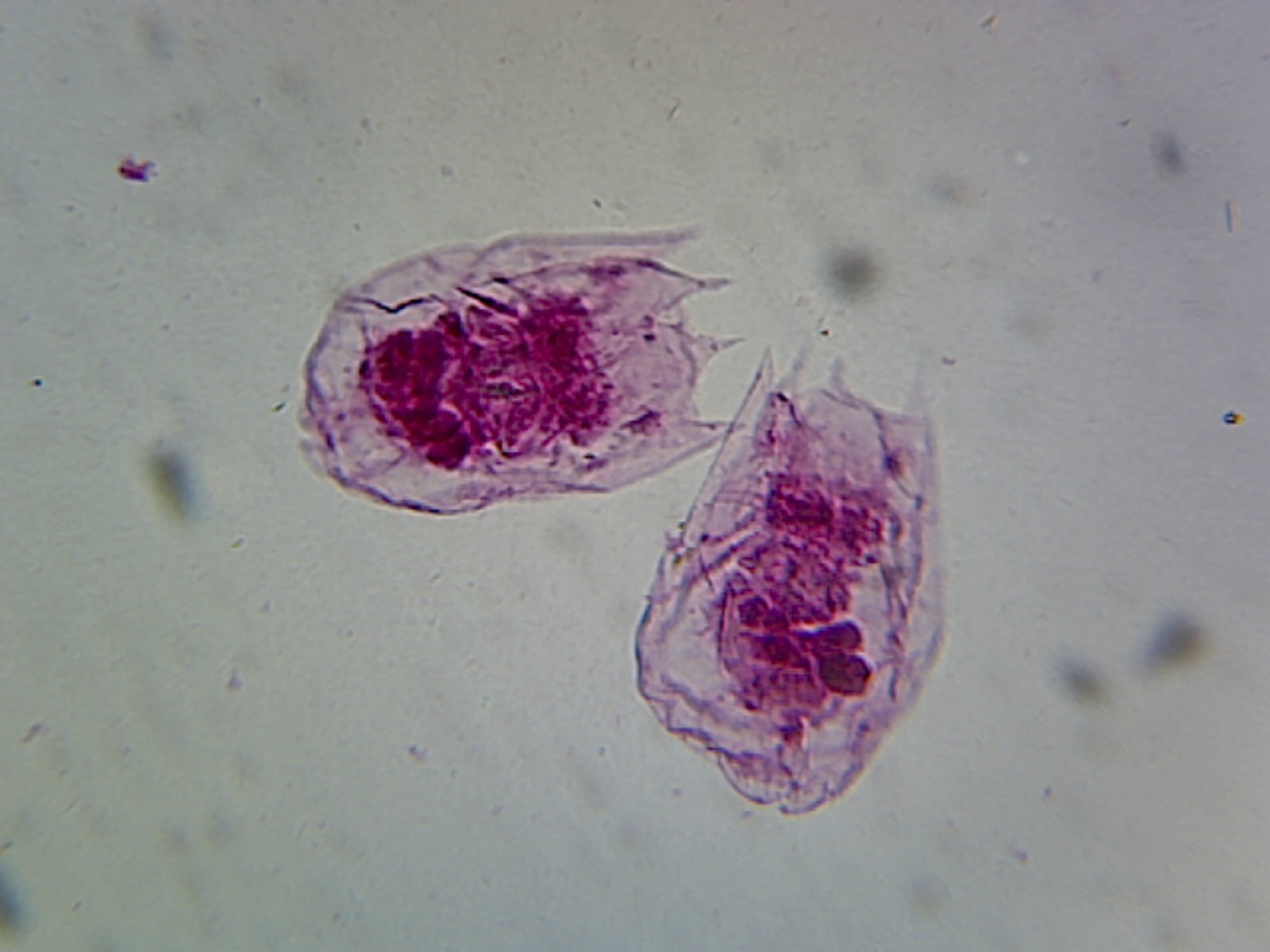 Prepared Microscope Slide, Vorticella (Ciliate, Peritrich) by Go ...