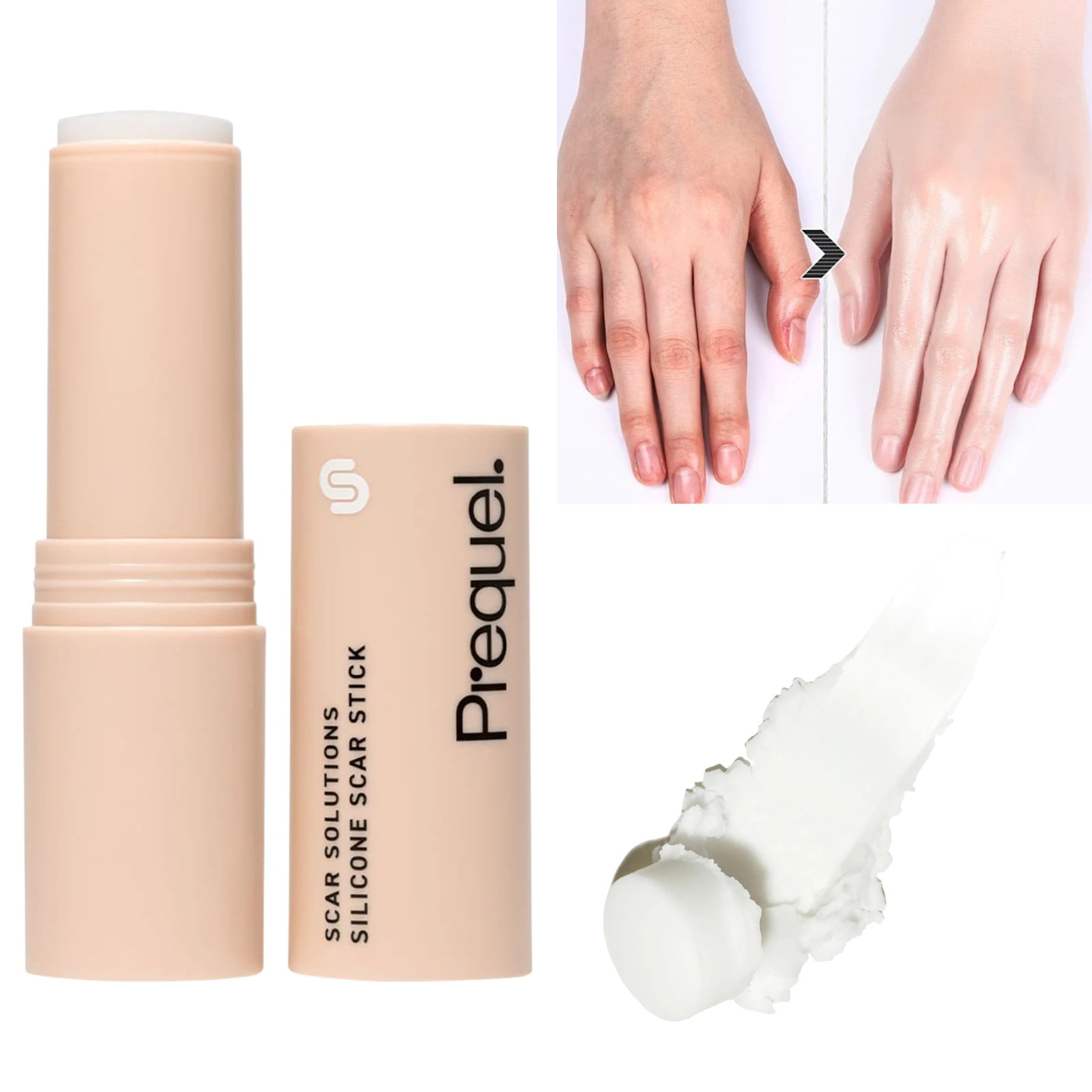 Prequel Scar Stick,Silicone Scar Stick,Contains 60% silicone, Gentle on ...