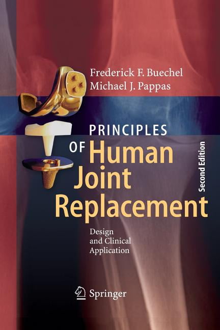 Principles of Human Joint Replacement: Design and Clinical Application ...