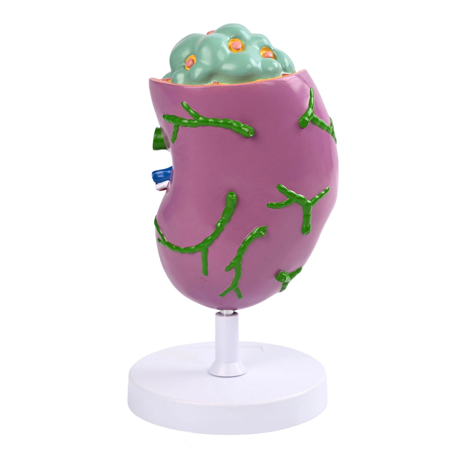 Professional Human Lymphatic Structure Model Color Coded Lymph Node ...