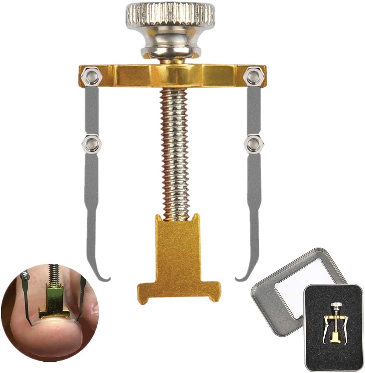 Professional Ingrown Toenail Correction Nail Clip Tool Ingrown ...