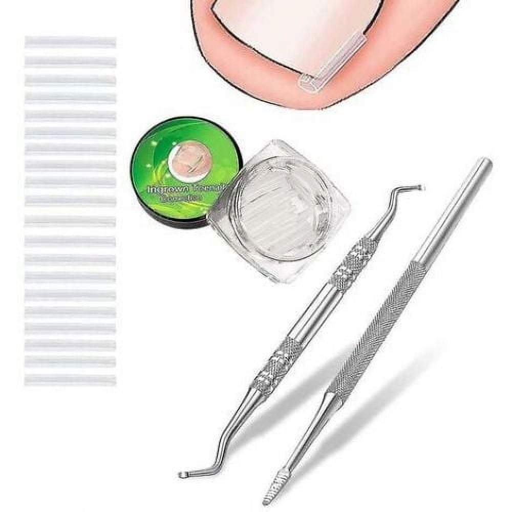 Professional Ingrown Toenail Correction Treatment Kit, Straightener ...