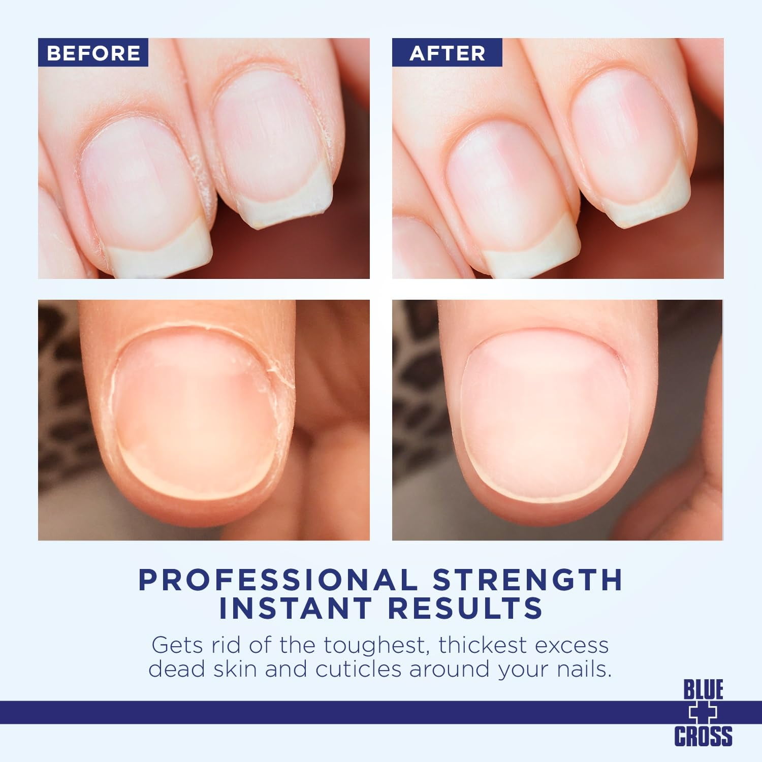 Professional Nail Care, Hydrating, Moisturizing, Strengthening Liquid ...