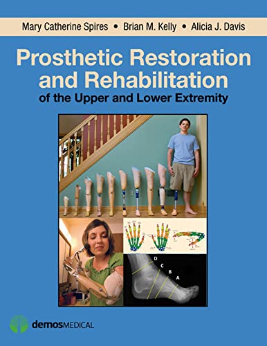 Pre-Owned Prosthetic Restoration and Rehabilitation of the Upper and ...