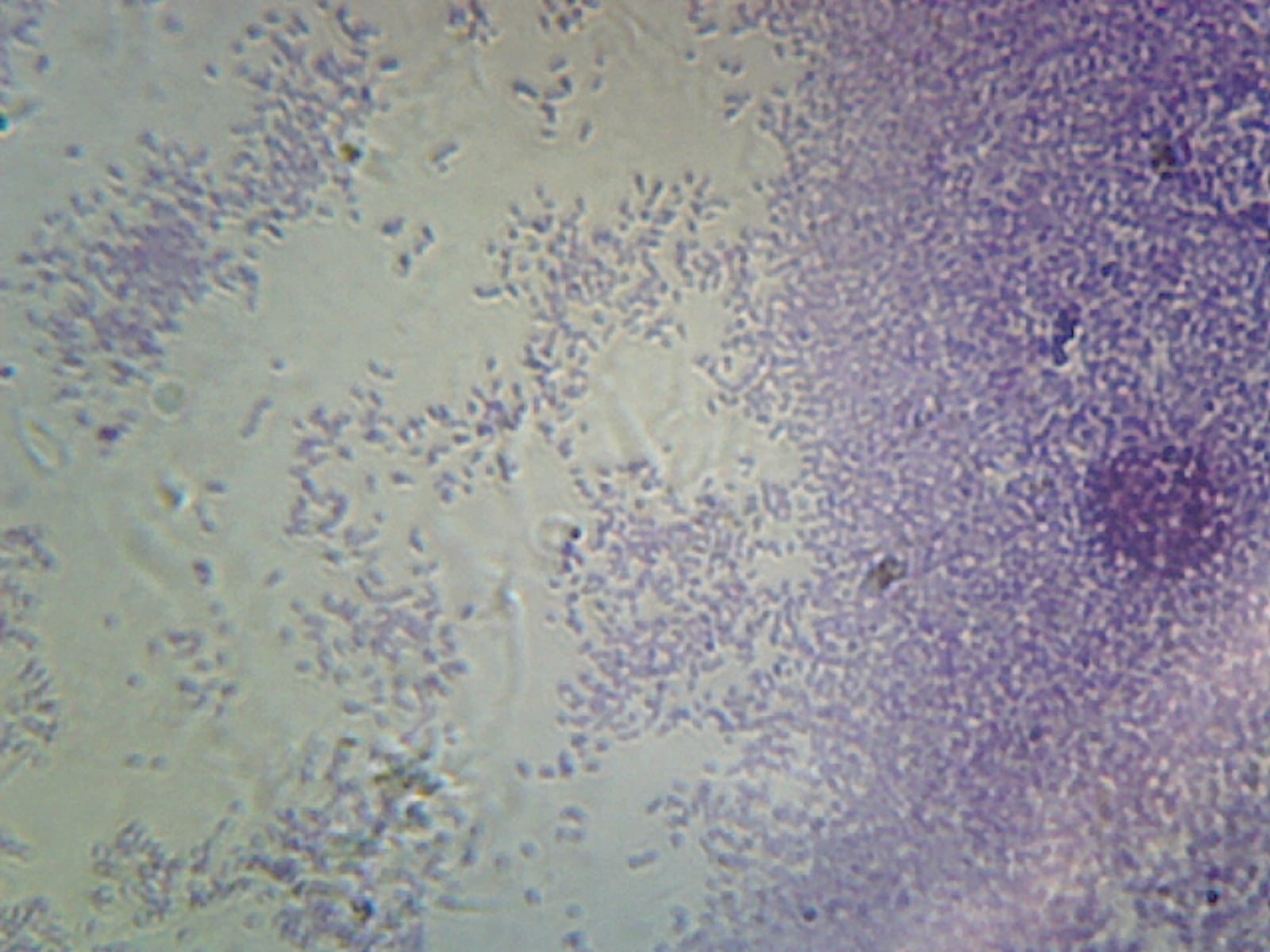 Proteus Vulgaris; Smear; Gram-Negative by Go Science Crazy - Walmart.com