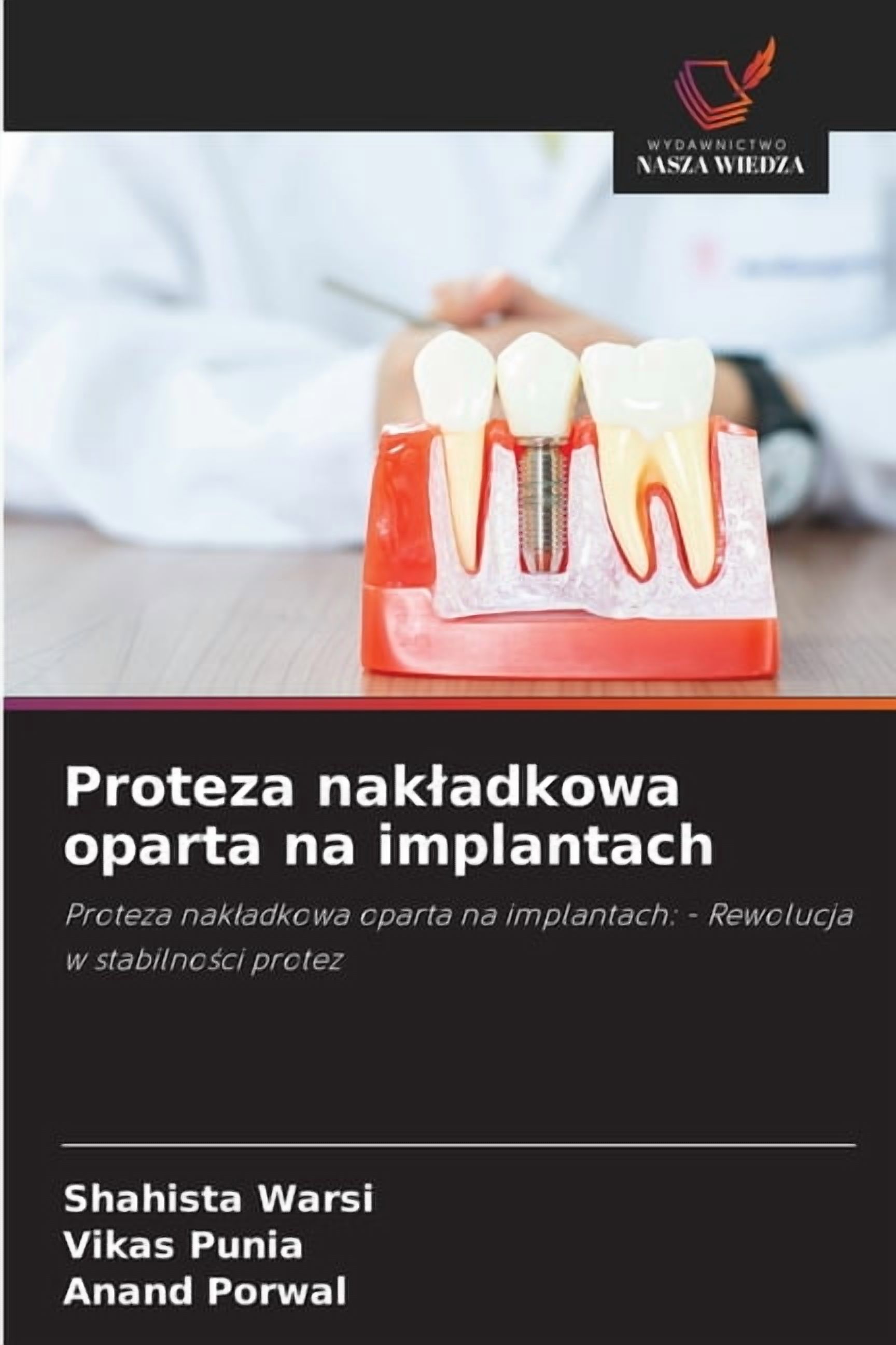 Proteza nakladkowa oparta na implantach, (Paperback) - Walmart.com